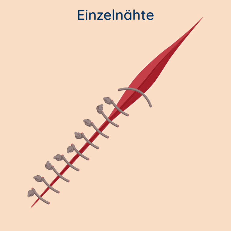 Nahttechniken - Versorgung dentalchirurgischer Wunden - Mednaht